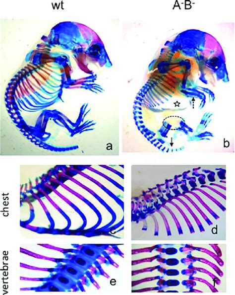 Newborn Cholinesterase Double Ko Mice Present Strong Skeletal