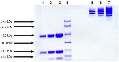 ハプトグロビン型判定意義 ハプトグロビン 基準値 ハプトグロビン Hp（haptoglobin） Wzsucb