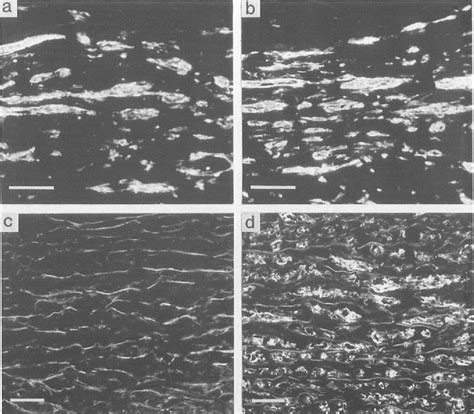 Figure 2 From Expression Of Extra Domain A Fibronectin Sequence In Vascular Smooth Muscle Cells