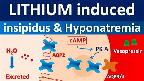 Lithium Induced Diabetes Insipidus And Hyponatremia Youtube