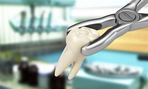 Retained Root Extraction Surgical Techniques And Considerations