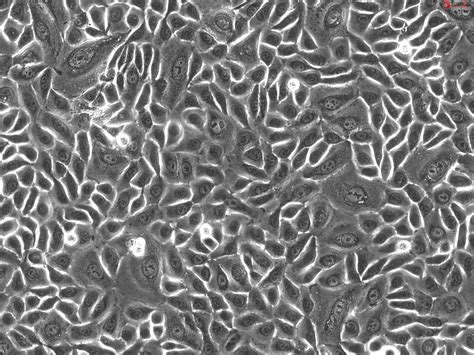 Human Cervical Epithelial Cells Passage 1
