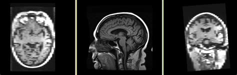 EMSegmenter Tasks MRI Human Brain HIPR Slicer Wiki