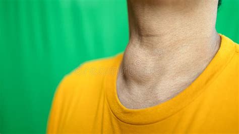 Thyroid Gland Inflammation At Neck Goiter Throat Cancer Sore Throat