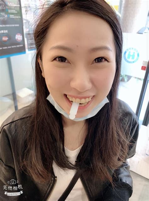 隱適美見證人生】我的咬棒 我的態度 靜思牙醫診所隱適美隱形牙套invisalign板橋矯正