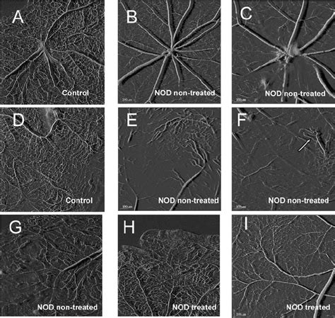 Composite Fluorescent Confocal Microscope Images Showing The Extent Of Download Scientific