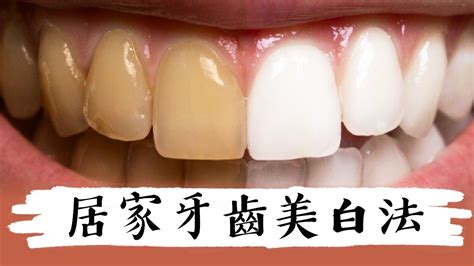 居家牙齿美白法自然疗法柏格医生dr Berg Youtube