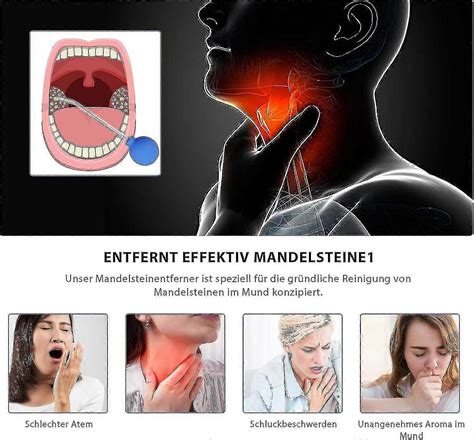 Tonsil Stone Remover Tonsil Stone Removal Tool Tonsil Stone