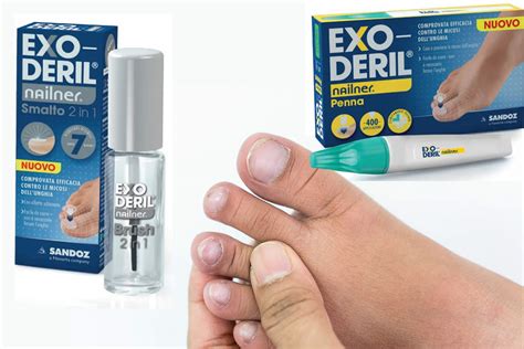 Exoderil Funziona Fa Male Uso Prezzo Opinioni