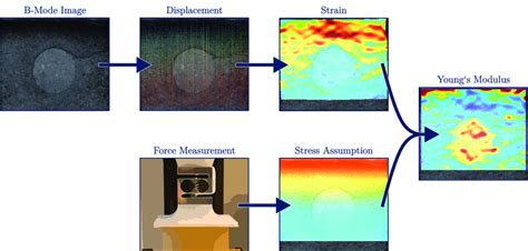 The Workflow Of The Presented Elastography Algorithm With The Basic Download Scientific Diagram