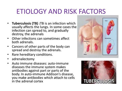 Adrenal Gland Disorders Pptx