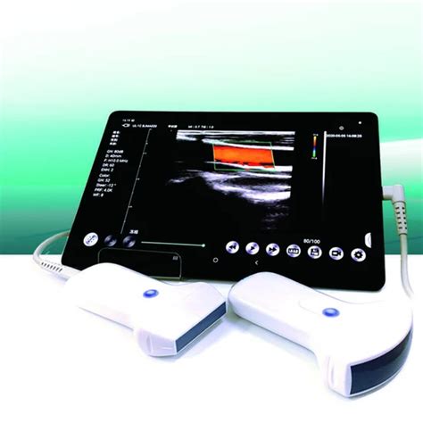 Handheld Convex Linear Doppler Wireless Usb Probe Type Ultrasound Probe