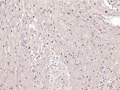 Rabbit Anti Phospho Irf3 Ser396 Polyclonal Antibody 爱必信 Absin 官网
