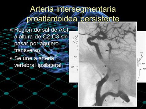 AnatomÃ­a AngiogrÃ¡fica Arterias El Blog De Godie