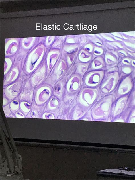 Elastic Cartilage Diagram Quizlet