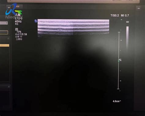 L12 3 Linear Array Transducer Probe Ultrasound Crystal And Cable