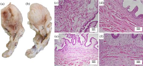 Urinary Tract After Catheterization In Rabbit With A Uncoated