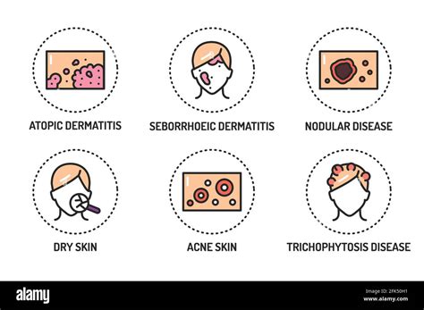 Malignant Diseases Stock Vector Images Alamy