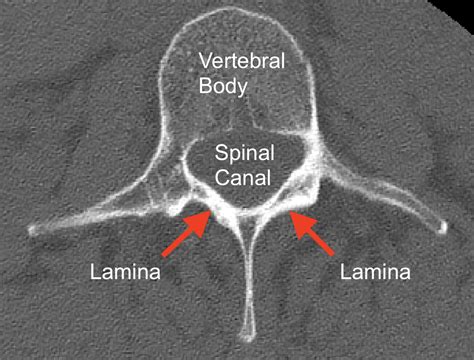 Laminae Body