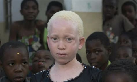 Hace 11 Años Nació Un ángel Blanco De Una Pareja Nigeriana Que Belleza Se Ha Vuelto La Chica