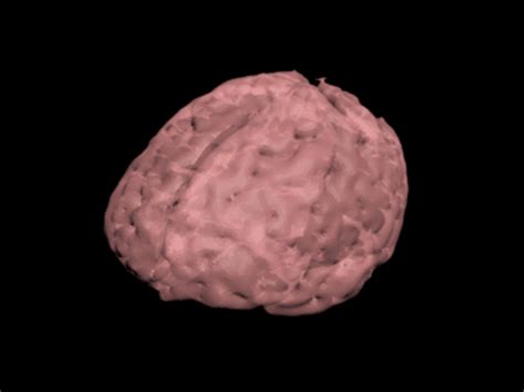 Brain Parenchyma Add On Feature For Brain Phantom