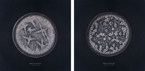 Fascinating Photos Reveal What Tears Look Like Under A Microscope