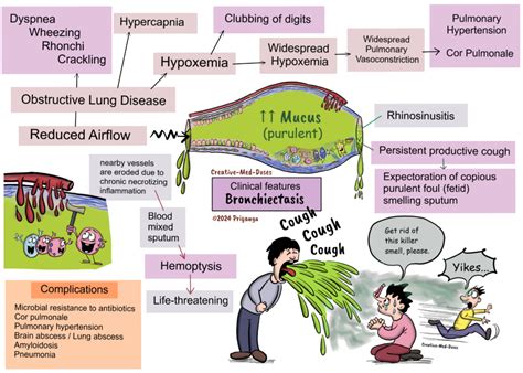 Bronchiectasis Creative Med Doses Bronchiectasis