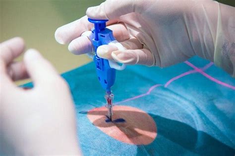 Skin Excision And Biopsy Main Street Medical