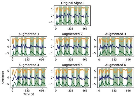Electronics Free Full Text Time Series Segmentation Using Neural