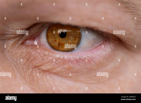 Closeup Mature Human Eye Lower Upper Eyelid Deep Wrinkles Around