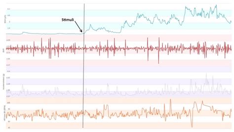 Continuous Stress Detection Using Wearable Sensors In Real Life Algorithmic Programming Contest