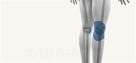 범어퍼스트정형외과