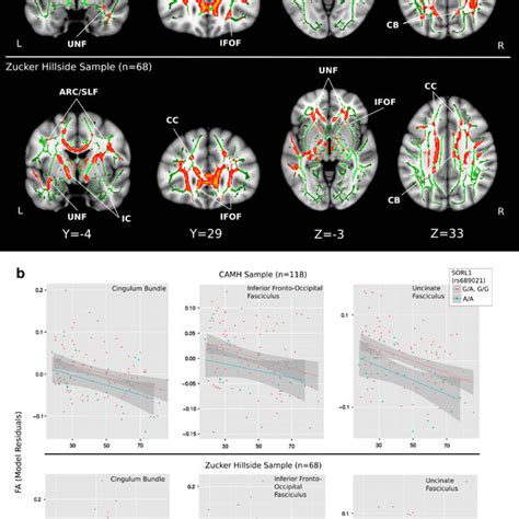 Results Of Tract Based Spatial Statistics Tbss White Matter Analysis Download Scientific