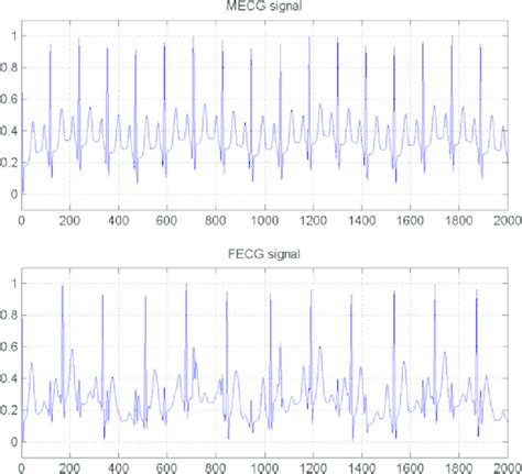 Ecg Signal Vector Sources With Dependent Components Generated From Amh