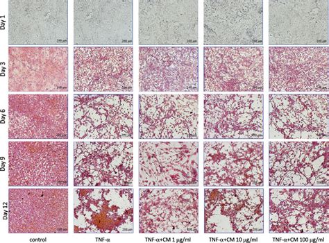 Late Stage Of Osteoblast Differentiation Observed With Alizarin Red S