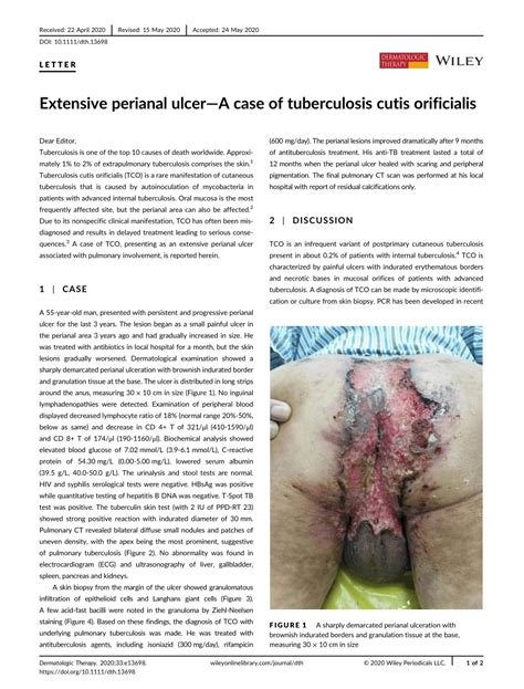 Tuberculosis Cutis Orificialis