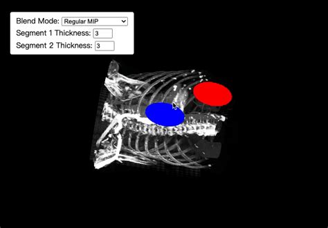 超越 Three Js！vtk Js 的每一个效果都很惊艳！ 51cto Com