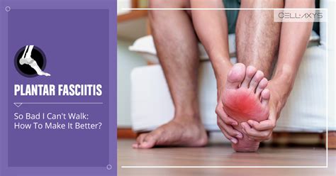 Plantar Fasciitis So Bad I Can T Walk How To Make It Better Cellaxys