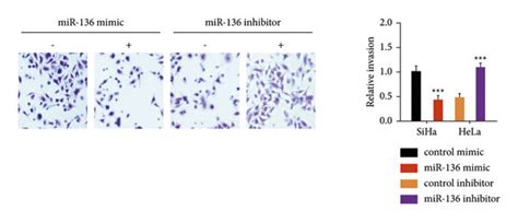 Mir 136 Suppresses Cervical Cancer Cell Invasion Sphere Formation And
