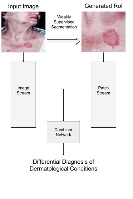 dermatological disease classification using consumer grade images by