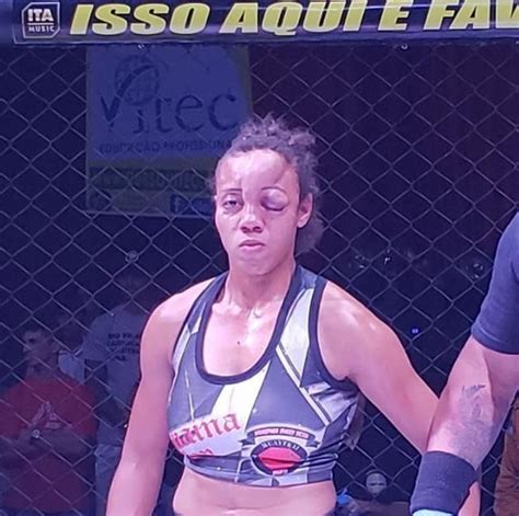 Ouch Fighter Suffers Worst Head Injury Ever Seen In Mma Nsfw Mma