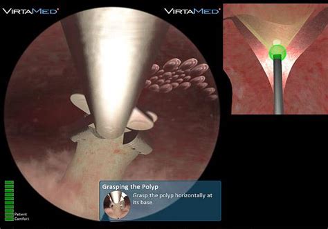 Gynos™ Hysteroscopy Training Modules Virtamed