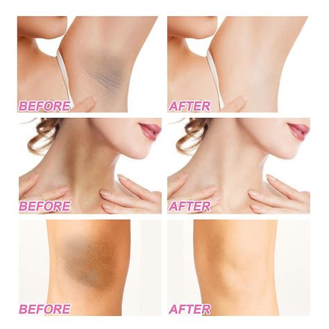 Underarm Brightening Cream Dark Spot Corrector Cream Skin Brightens
