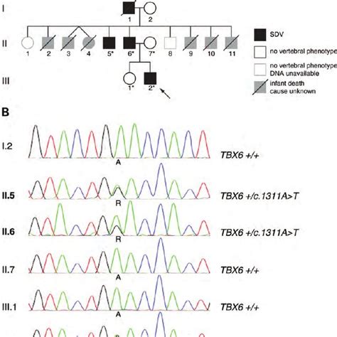 Functional Analysis Of The Tbx6 Mutation A Mutant Tbx6 Activates
