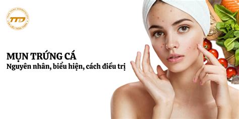 Mụn Trứng Cá Nguyên Nhân Biểu Hiện Và Cách điều Trị