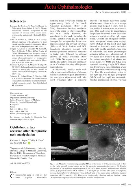 Pdf Ophthalmic Artery Occlusion After Chiropractic Neck Manipulation