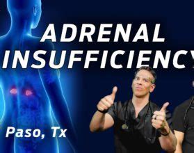A Chiropractor Causes Of Piriformis Syndrome Dr Jimenez D C