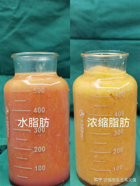 苹果肌凹陷怎么办？有什么方法？ 知乎