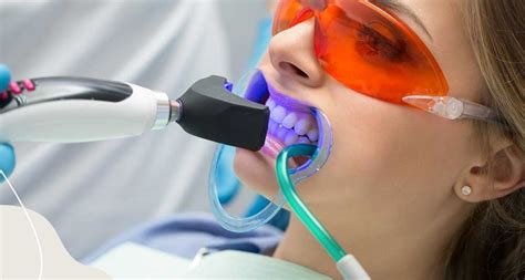 Teeth Whitening Cost Expert Vs Over The Counter Methods