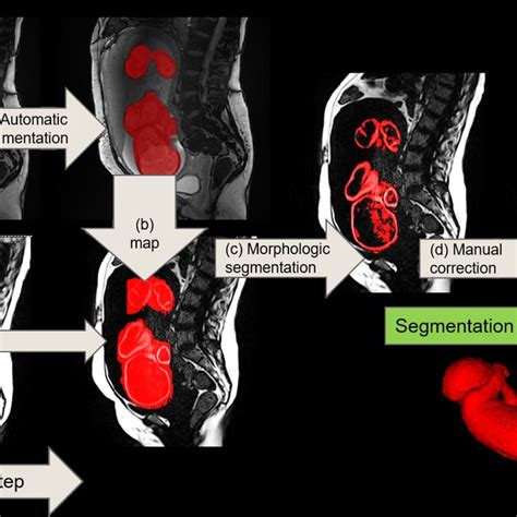 Automatic Fetal Fat Segmentation The Inputs Light Blue Are Fat Only Download Scientific